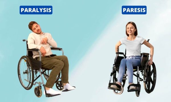 Can Sleep Paralysis Cause Death? Causes, Symptoms and Treatment - PMRI ...