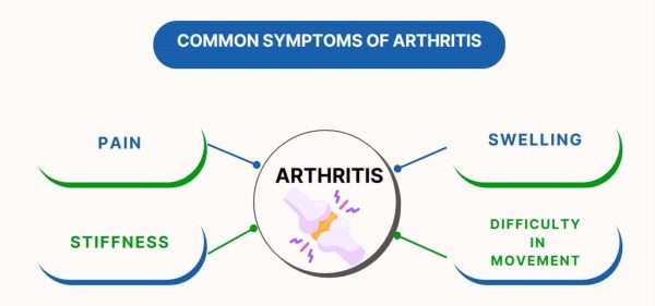What is Arthritis? Its Causes, Symptoms and Probable Treatments - PMRI ...