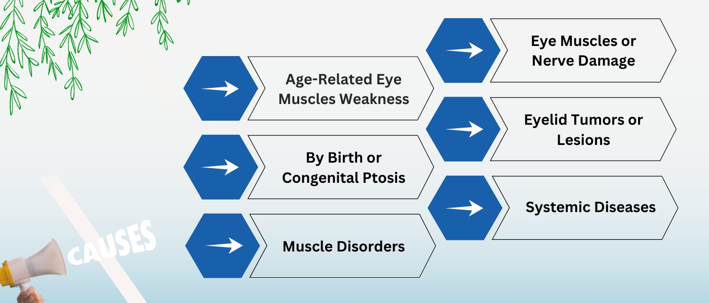 Ptosis (Droopy Eyelids) Causes, Symptoms and Treatment